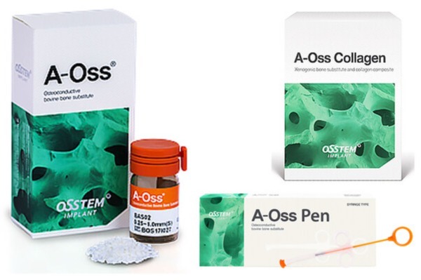 이종골 이식재 ‘A-Oss’ 시리즈... “꾸준히 라인업 확대, 개원가에서도 호평!”