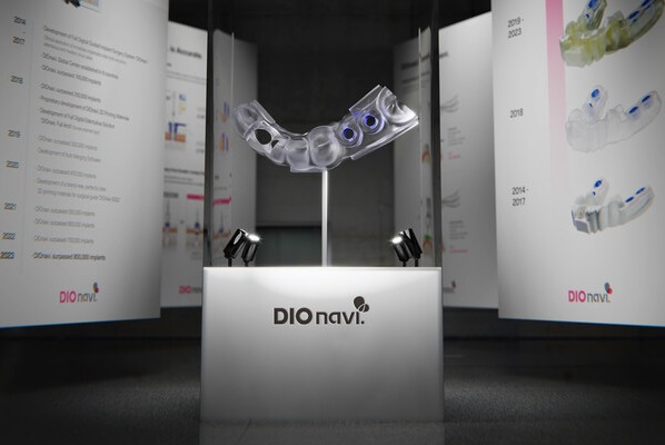 DIOnavi 누적 80만 홀 돌파... “정확도, 편의성, 다양한 적응증 등 높은 점수!”