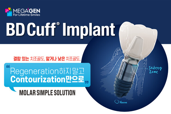메가젠임플란트... “구치부 솔루션 ‘BD Cuff™’, 구강스캐너 ‘R2i3’ 출시!”