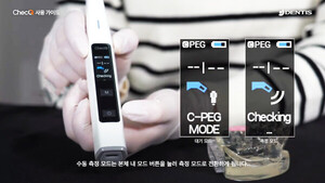 덴티스의 임플란트 고정도 측정기 ‘ChecQ(첵큐)’... “이렇게 사용합니다!”