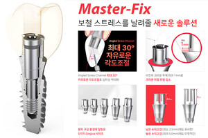 아름덴티스트리... “시멘리스 보철 시스템 ‘Master Fix’, FDA 인증 획득!”