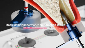 드릴 최소화, 프로토콜 간소화... “디오, ‘DIOnavi. Master S Kit’ 출시!”